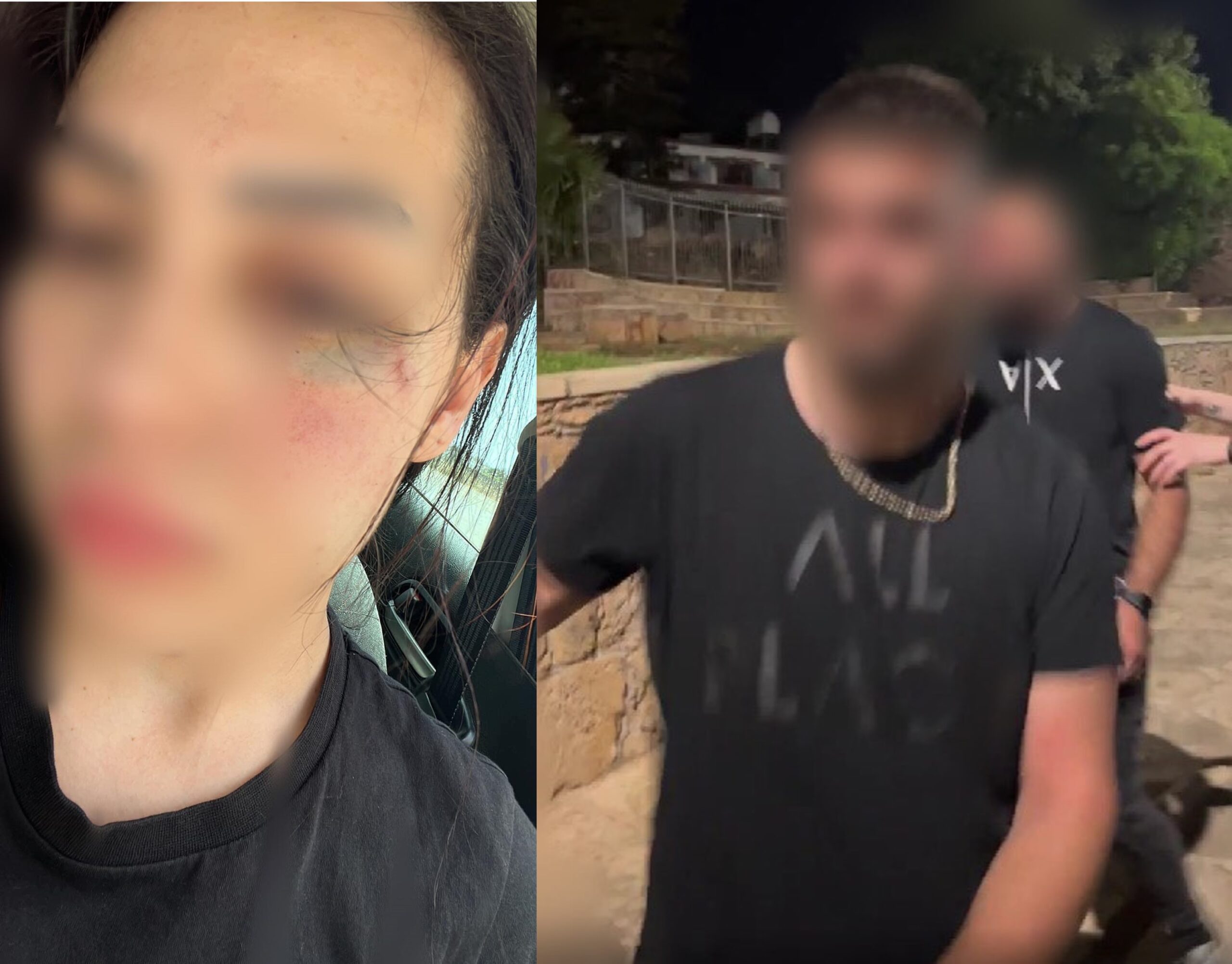 Έφερε ρόπαλο άτομο από την παρέα της 25χρονης, πάει για συμπληρωματική ...